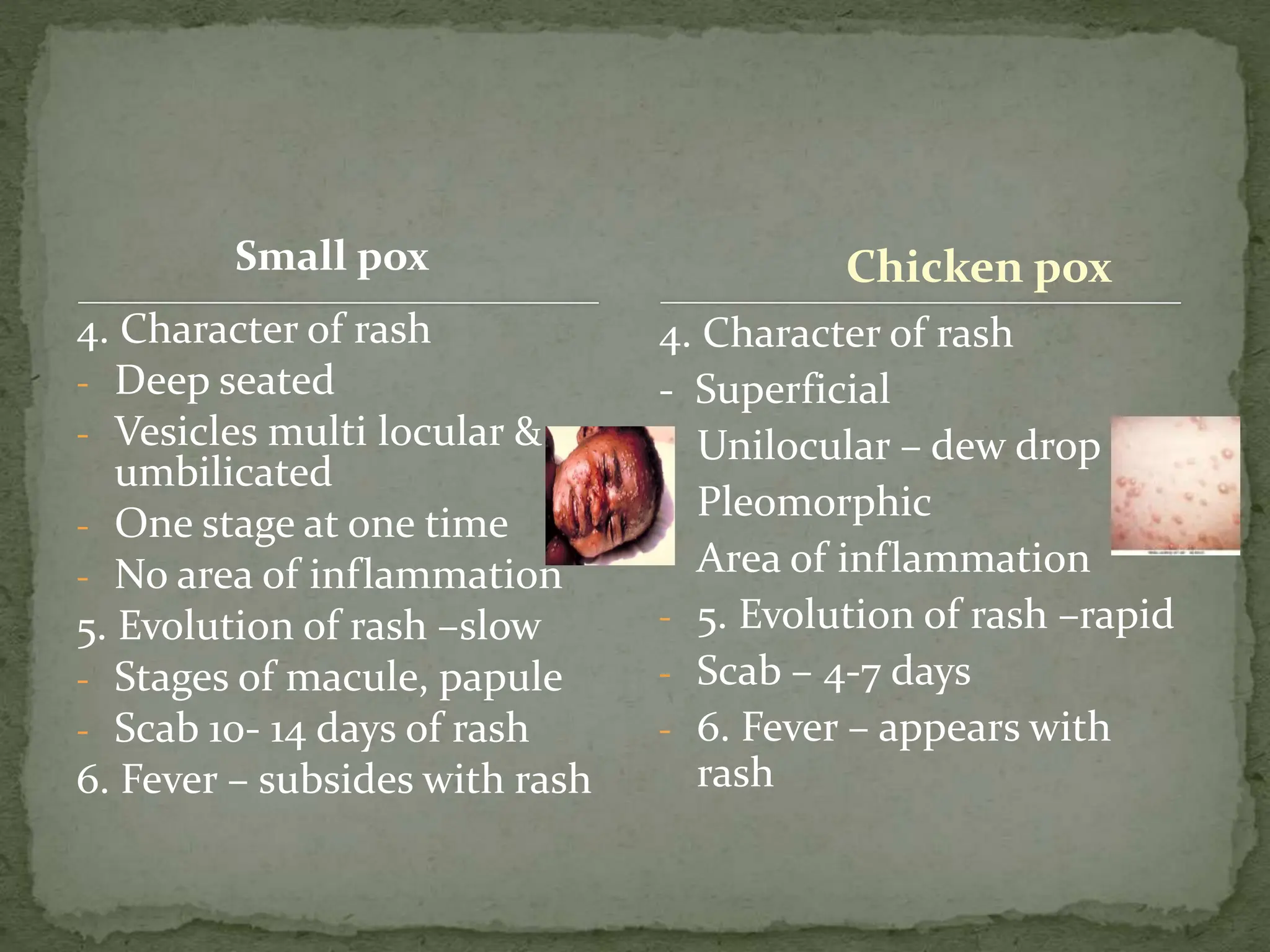 Prevention and control of Chickenpox.pptx