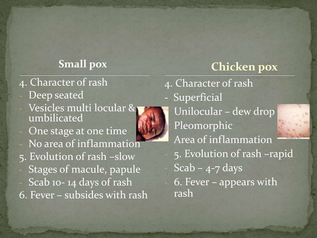 Prevention and control of Chickenpox.pptx