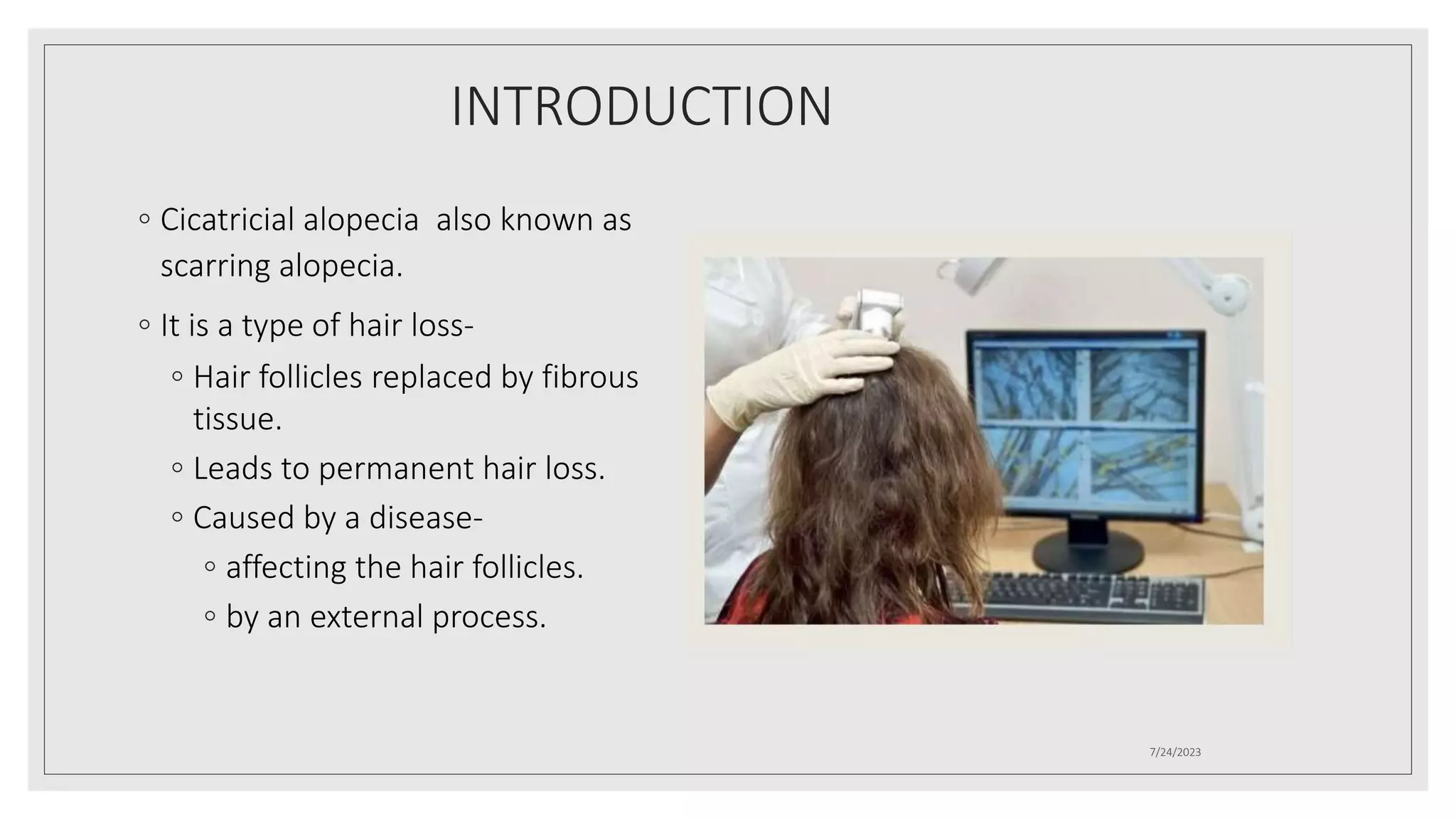 Trichoscopy of cicatricial alopecia.pptx