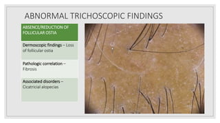 Trichoscopy of cicatricial alopecia.pptx