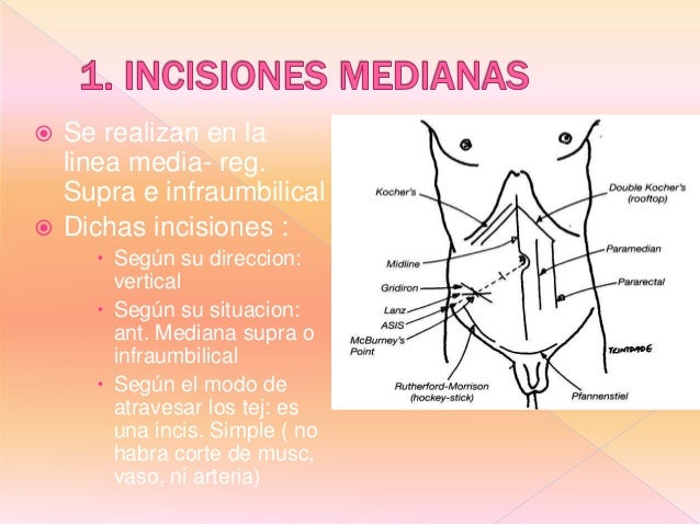 abdomen_ vias de acceso