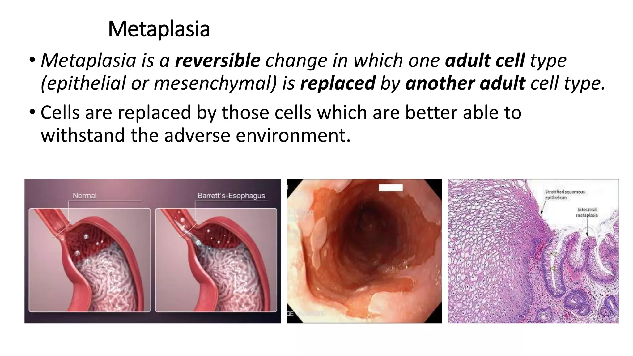 1 Class Cellular Adaptation.pptx