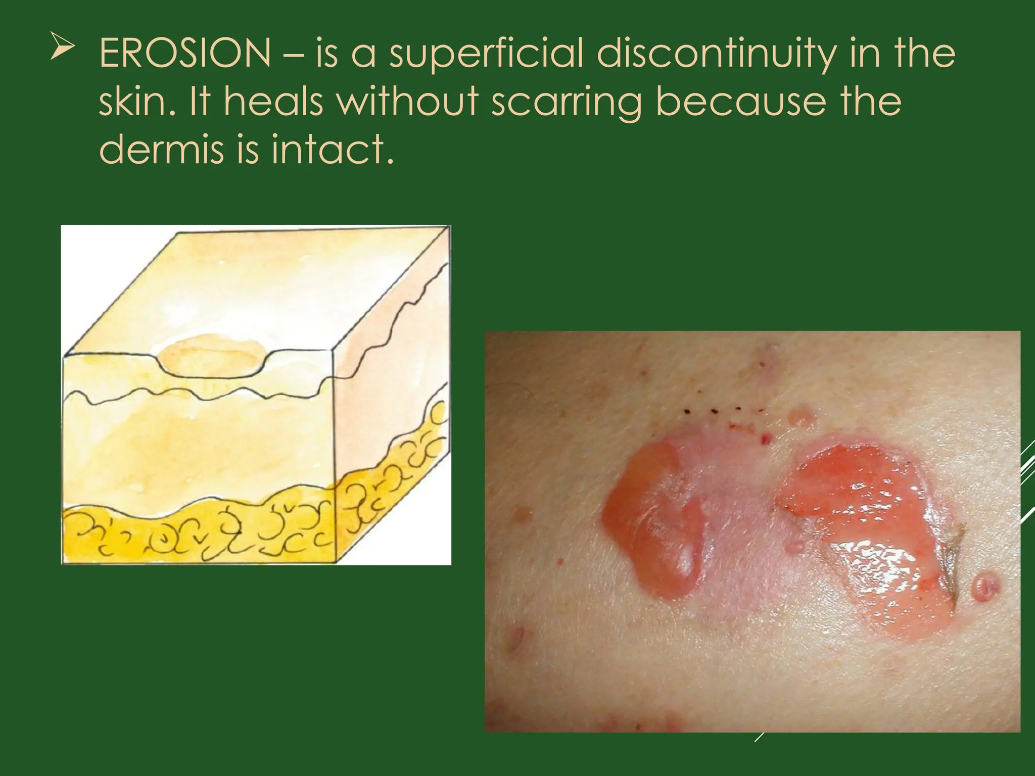 Dermatology and it's tasks skin anatomy .pptx