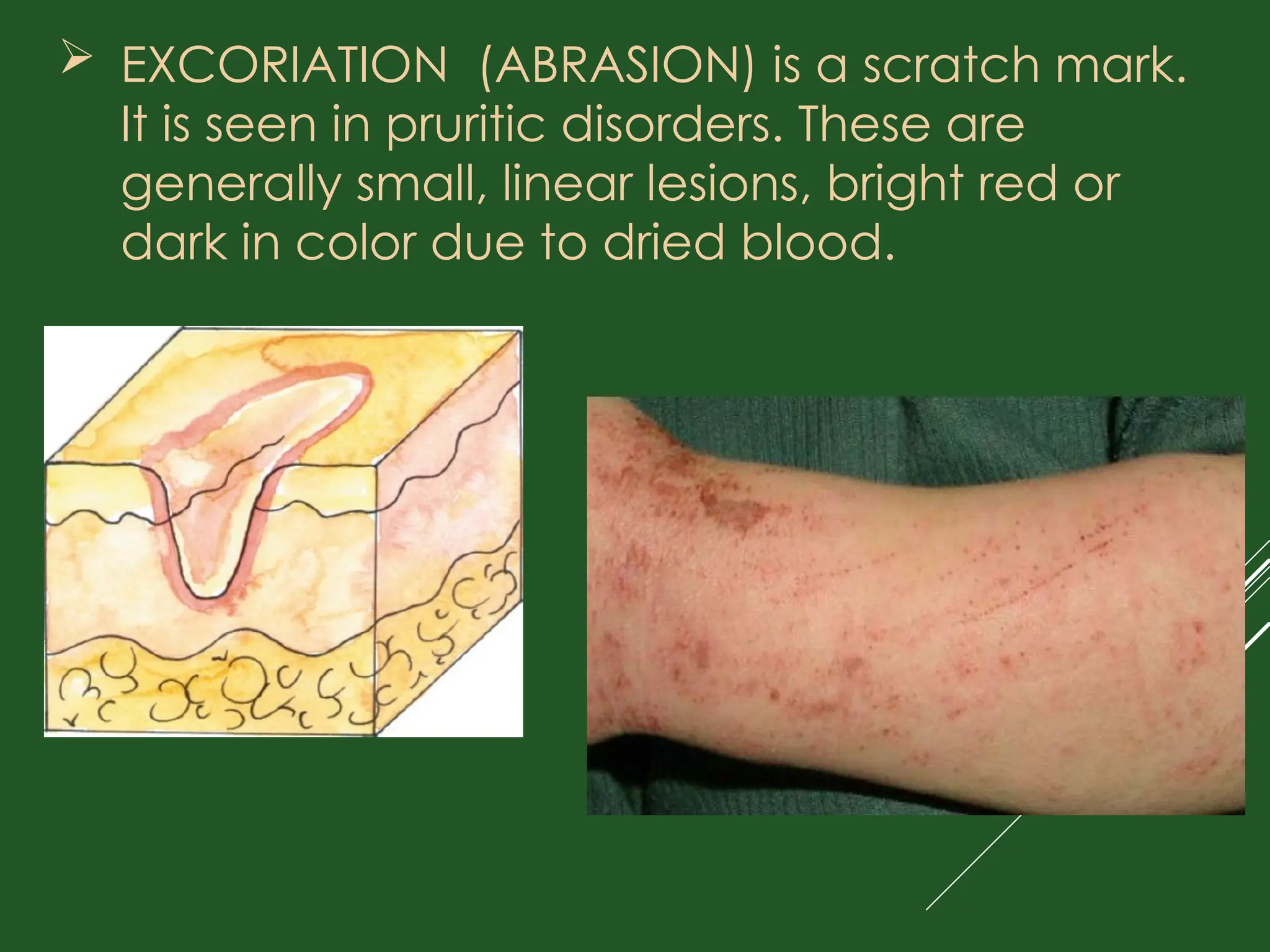 Dermatology and it's tasks skin anatomy .pptx