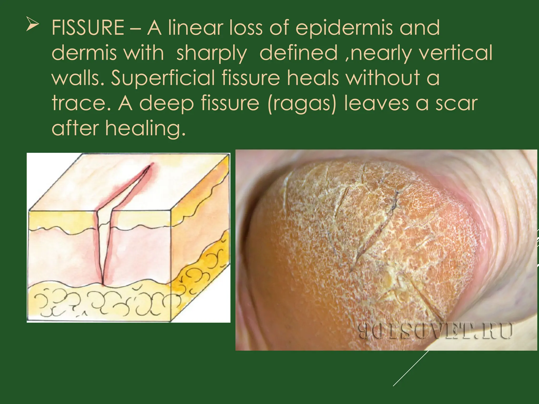 Dermatology and it's tasks skin anatomy .pptx
