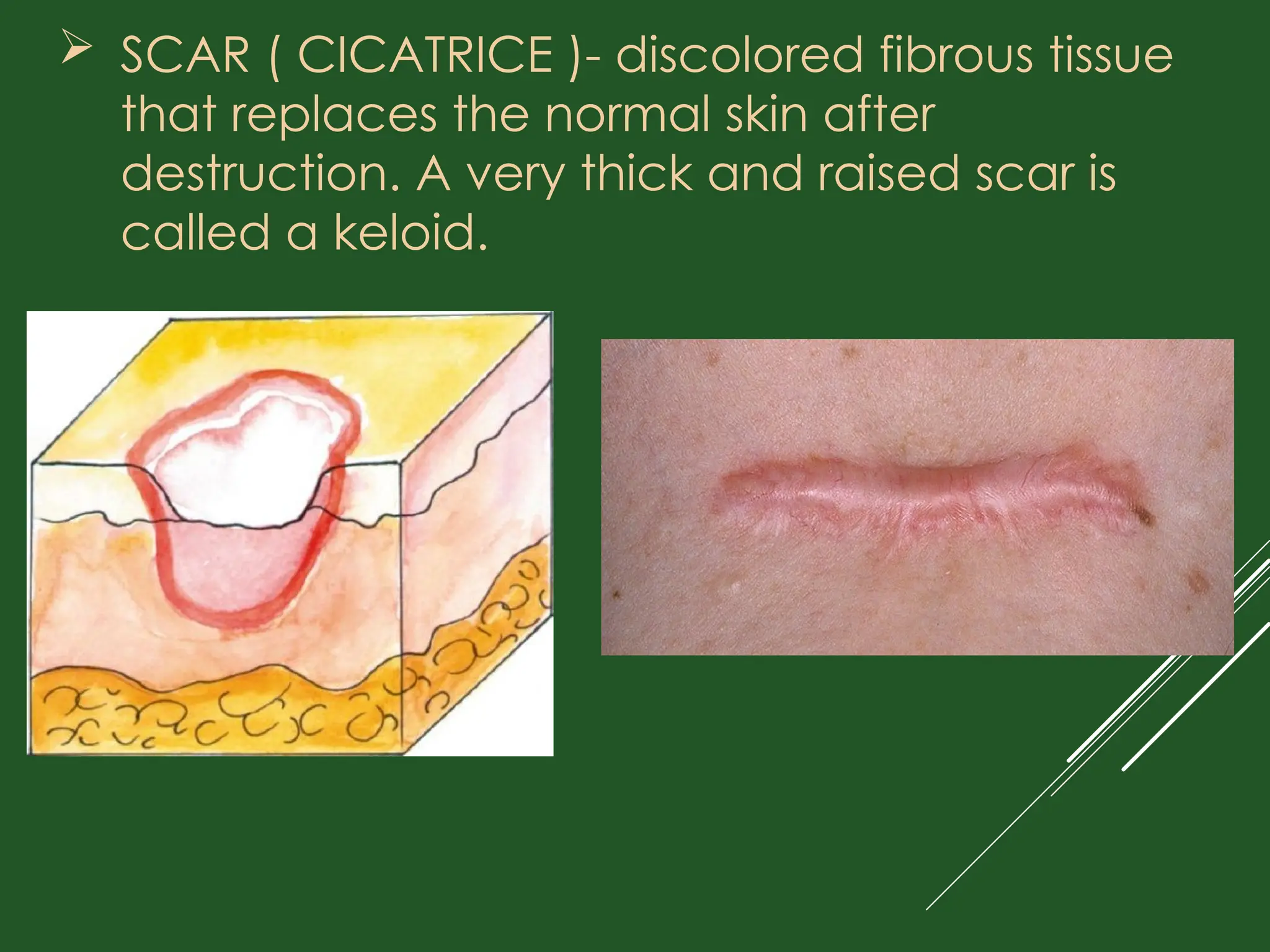 Dermatology and it's tasks skin anatomy .pptx