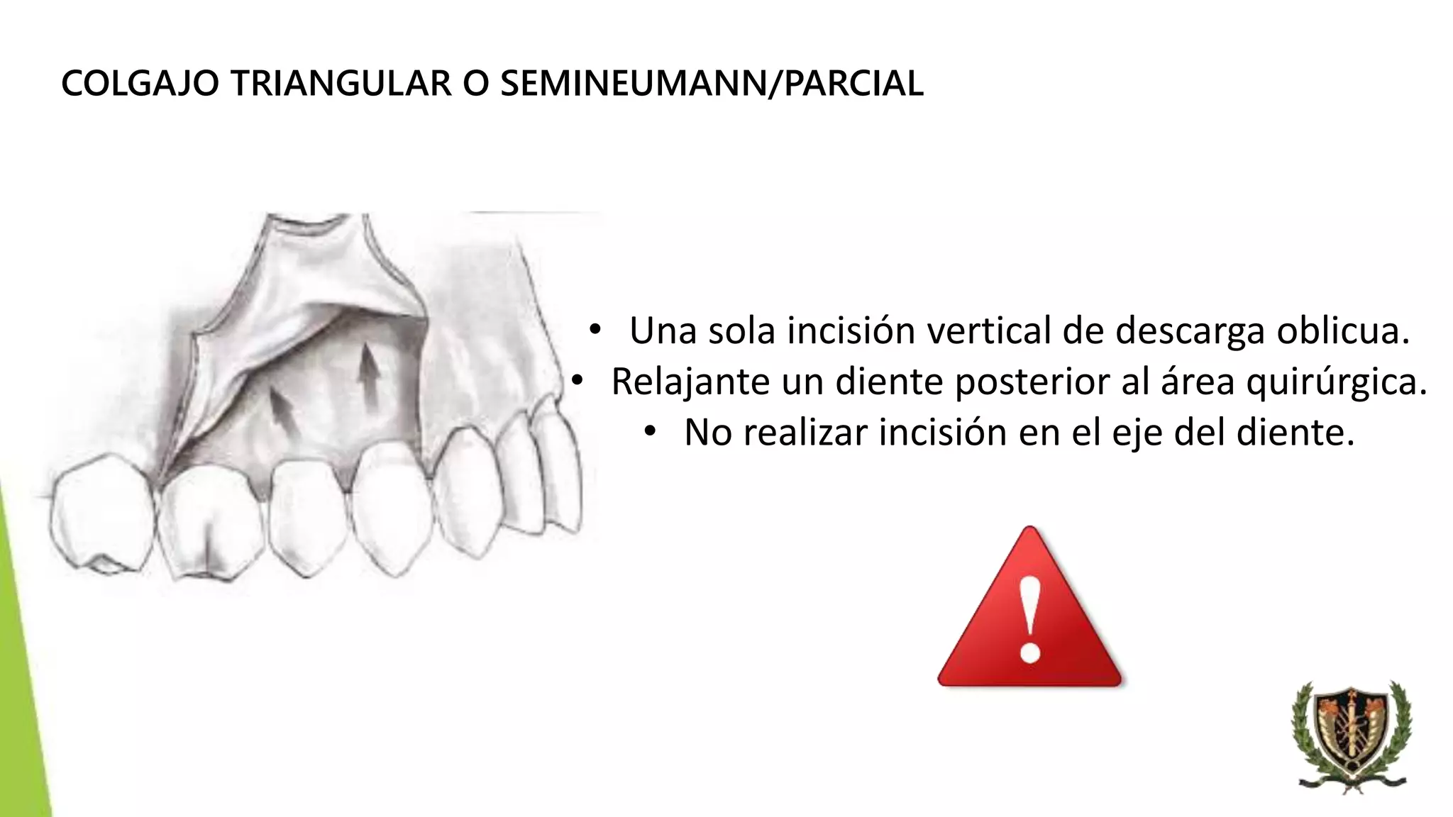 Colgajos de Cavidad Bucal | PPTX