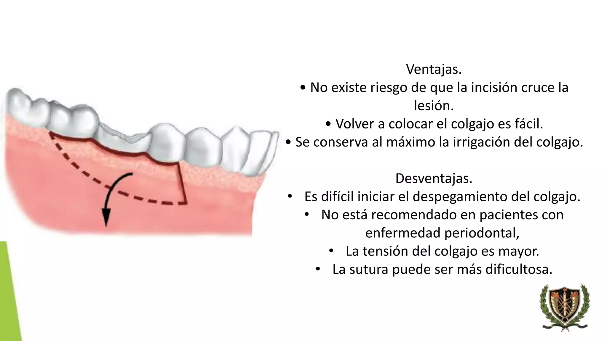 Colgajos de Cavidad Bucal | PPTX