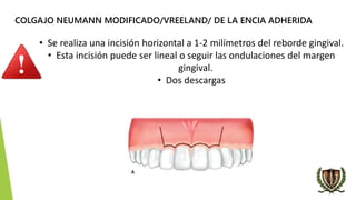 Colgajos de Cavidad Bucal | PPTX