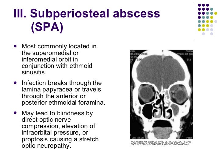 1 complications of rhinosonusitis