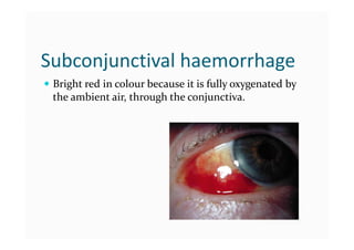 1 Conjunctiva.pdf