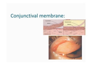 1 Conjunctiva.pdf