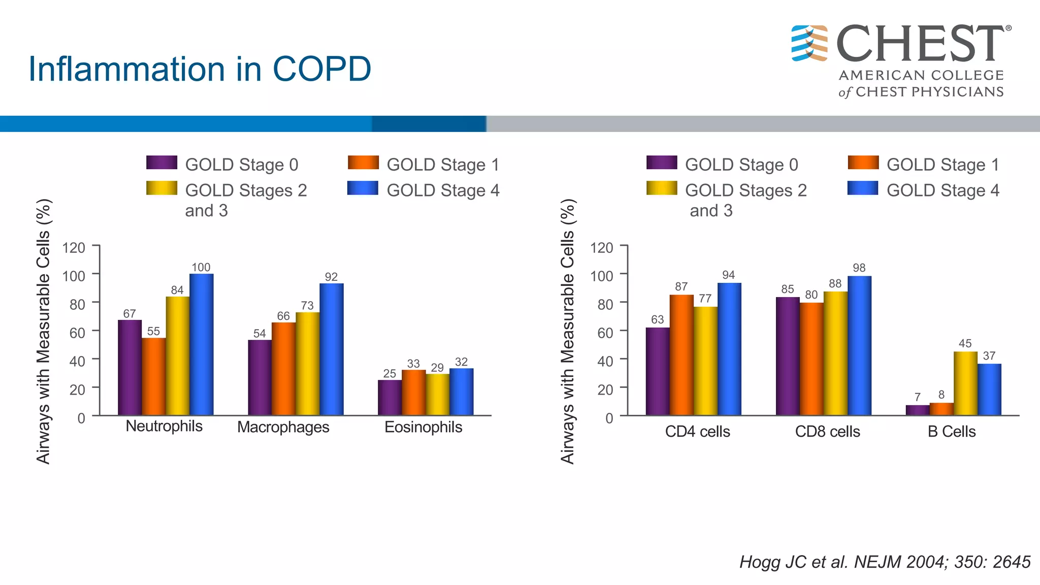 1_COPD_Part_1_Definition,_Epidemiology_and_Pathophysiology.pdf