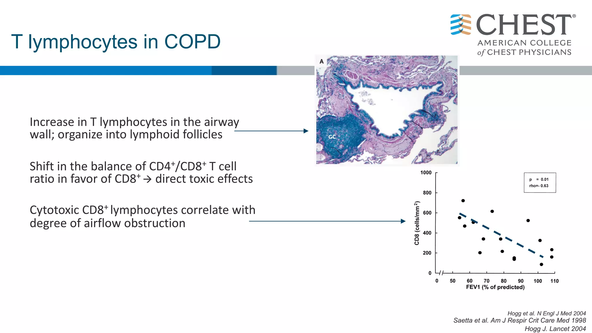 1_COPD_Part_1_Definition,_Epidemiology_and_Pathophysiology.pdf
