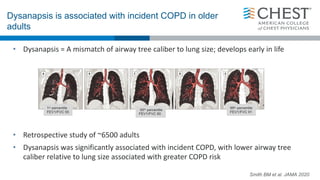 1_COPD_Part_1_Definition,_Epidemiology_and_Pathophysiology.pdf
