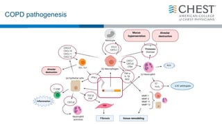 1_COPD_Part_1_Definition,_Epidemiology_and_Pathophysiology.pdf