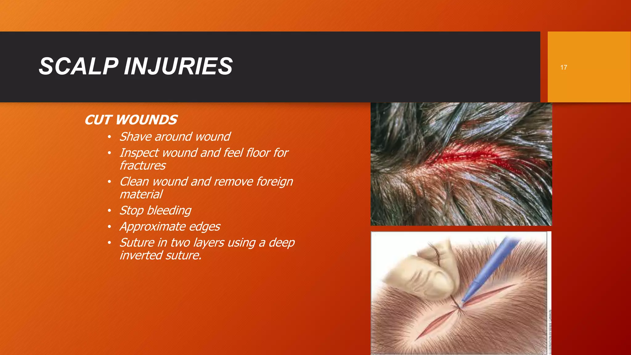 I LOVE NEUROSURGERY INITIATIVE: Cranio-cerebral Injuries part 1 | PPTX ...