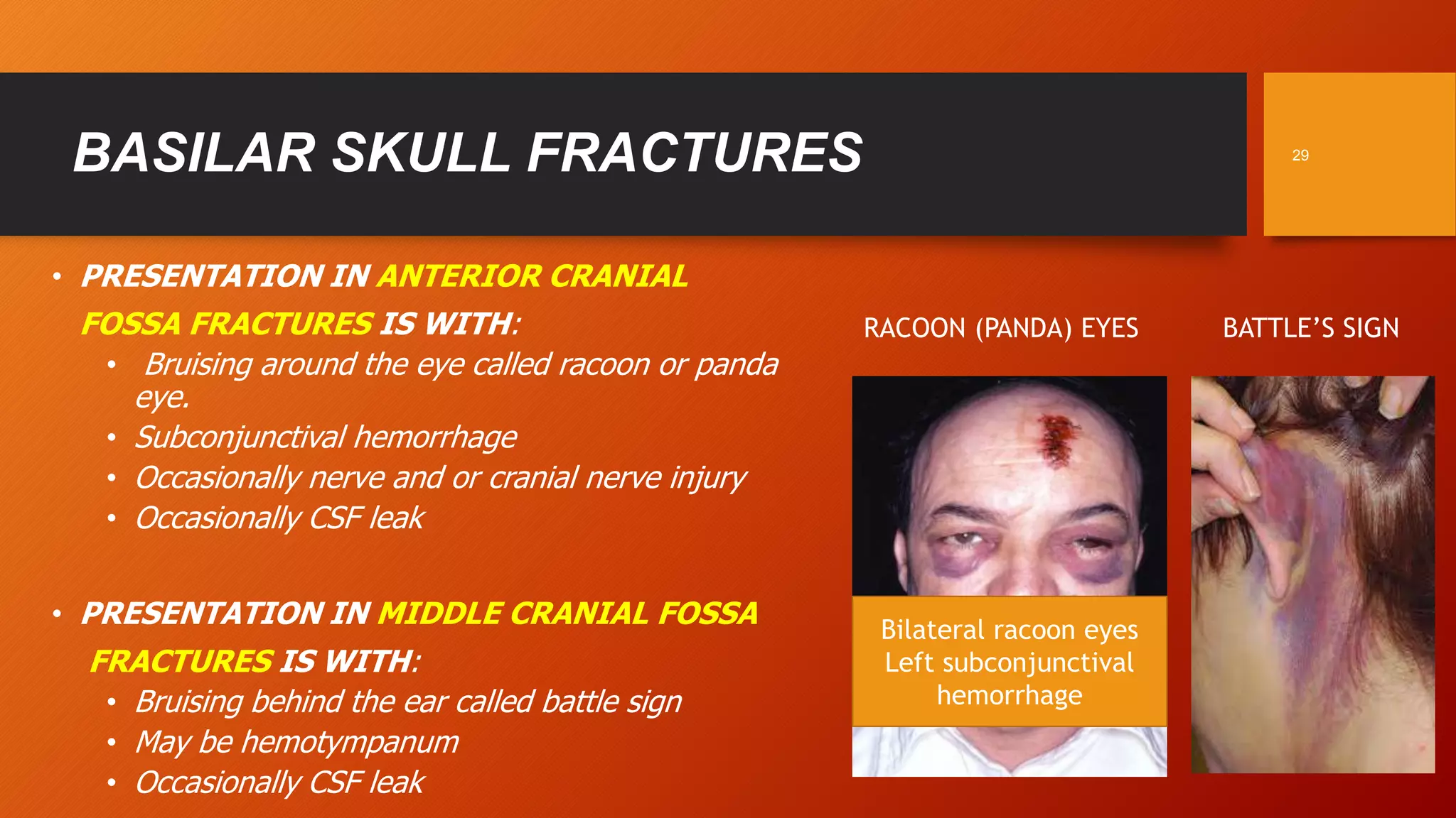 I LOVE NEUROSURGERY INITIATIVE: Cranio-cerebral Injuries part 1 | PPTX