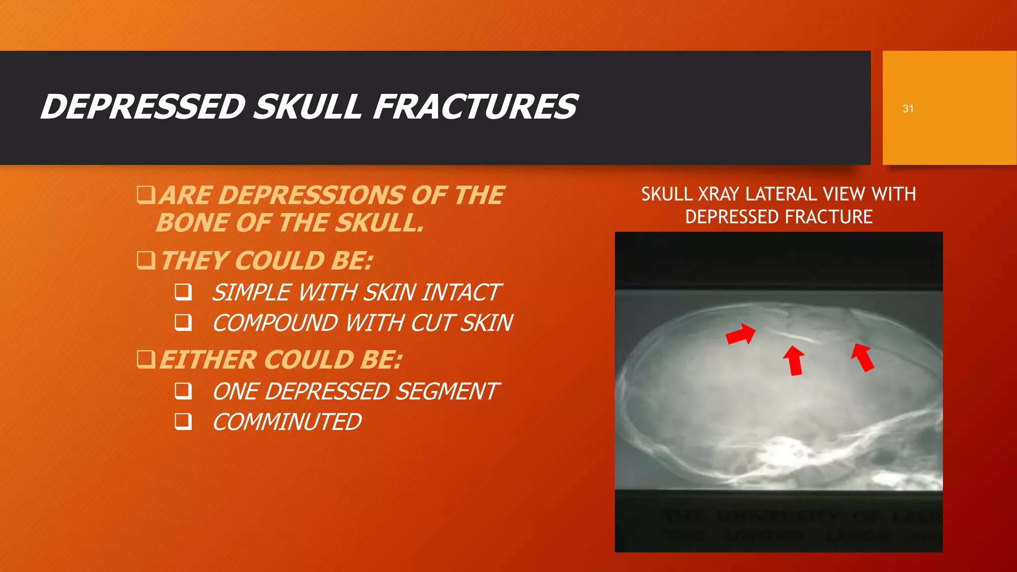 I LOVE NEUROSURGERY INITIATIVE: Cranio-cerebral Injuries part 1 | PPTX