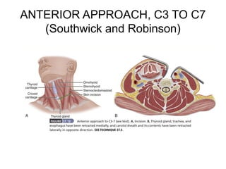 Cervical Spine anterior surgrical approach.pptx