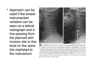 Cervical Spine anterior surgrical approach.pptx