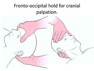 cranial manipulation | PPT