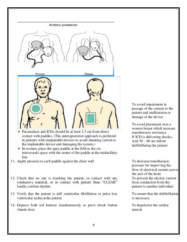 Anteroposterior Aed Placement