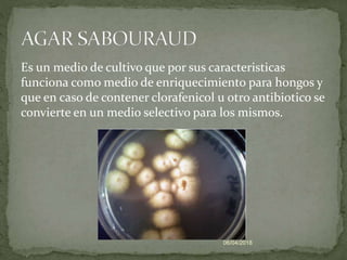 dermatophiulus congolensis- dermatofilosis | PPTX