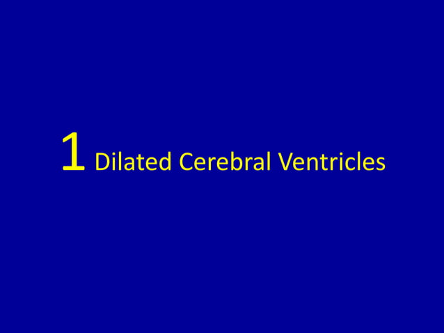 1 dilated cerebral ventricles Radiology | PPT