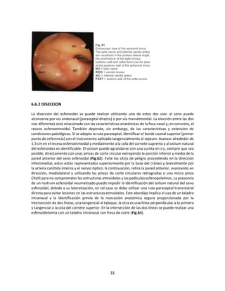 DISECCION ENDOSCOPICA EN CADAVER DE NARIZ Y SENOS PARANASALES.docx