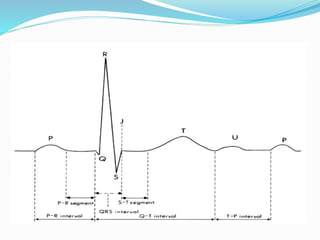 normal-electrocardiogram | PPTX