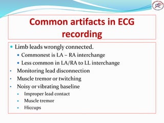 normal-electrocardiogram | PPTX