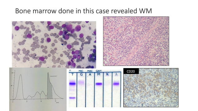 1_Dr Jasmita Das Peripheral blood smear examination with Romanowsky ...