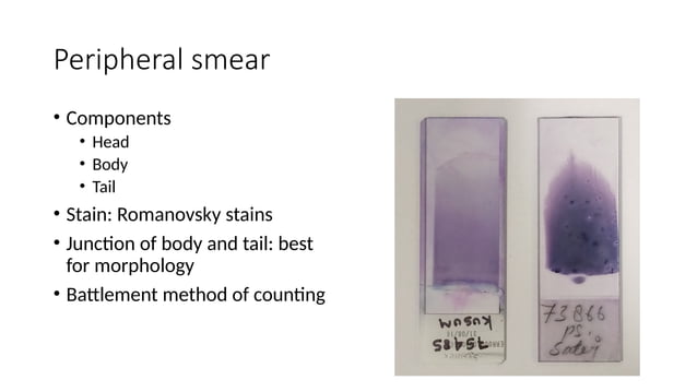 1_Dr Jasmita Das Peripheral blood smear examination with Romanowsky ...