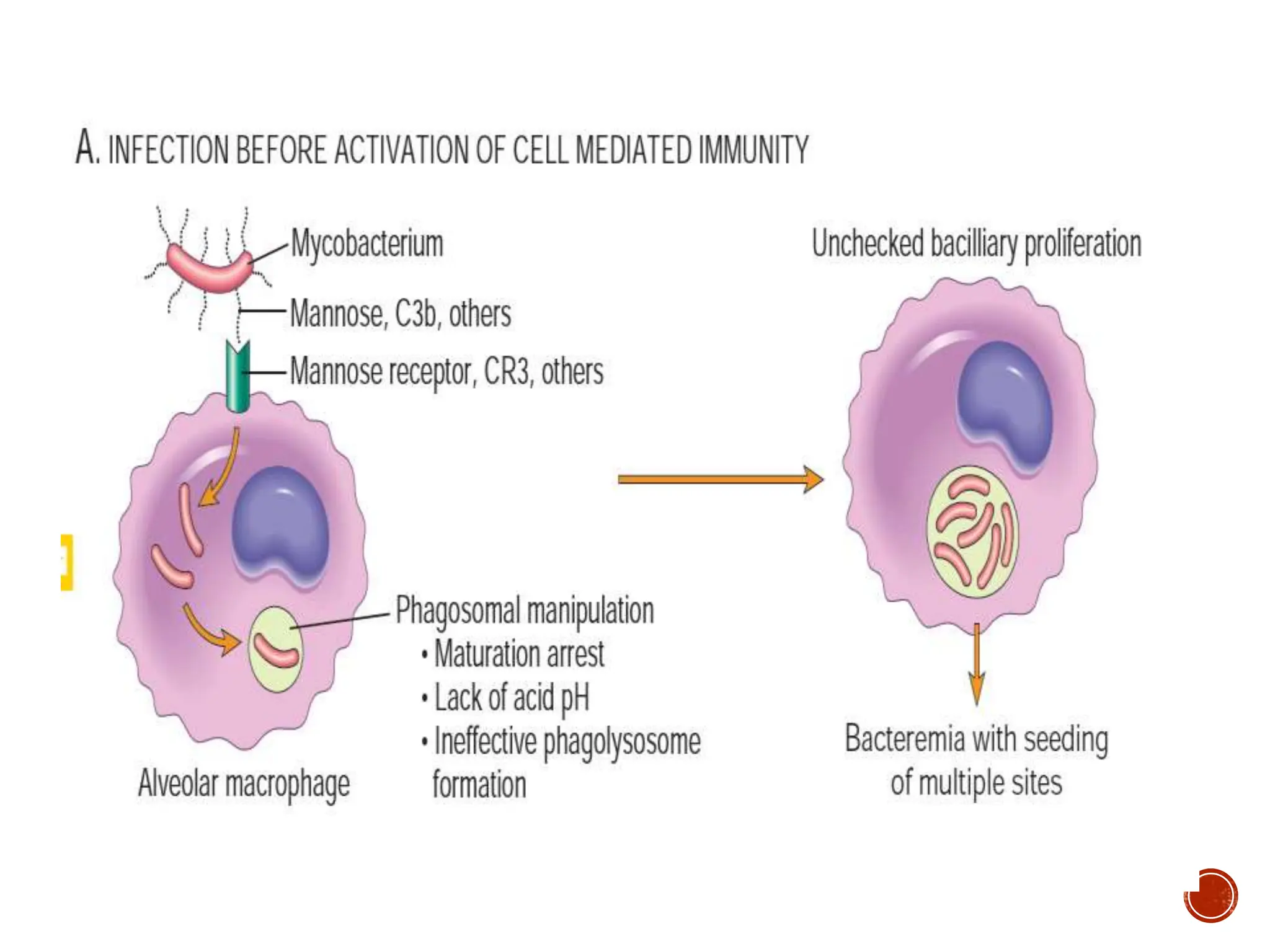 Pathophysiology of Tuberculosis and it's Complications | PPTX