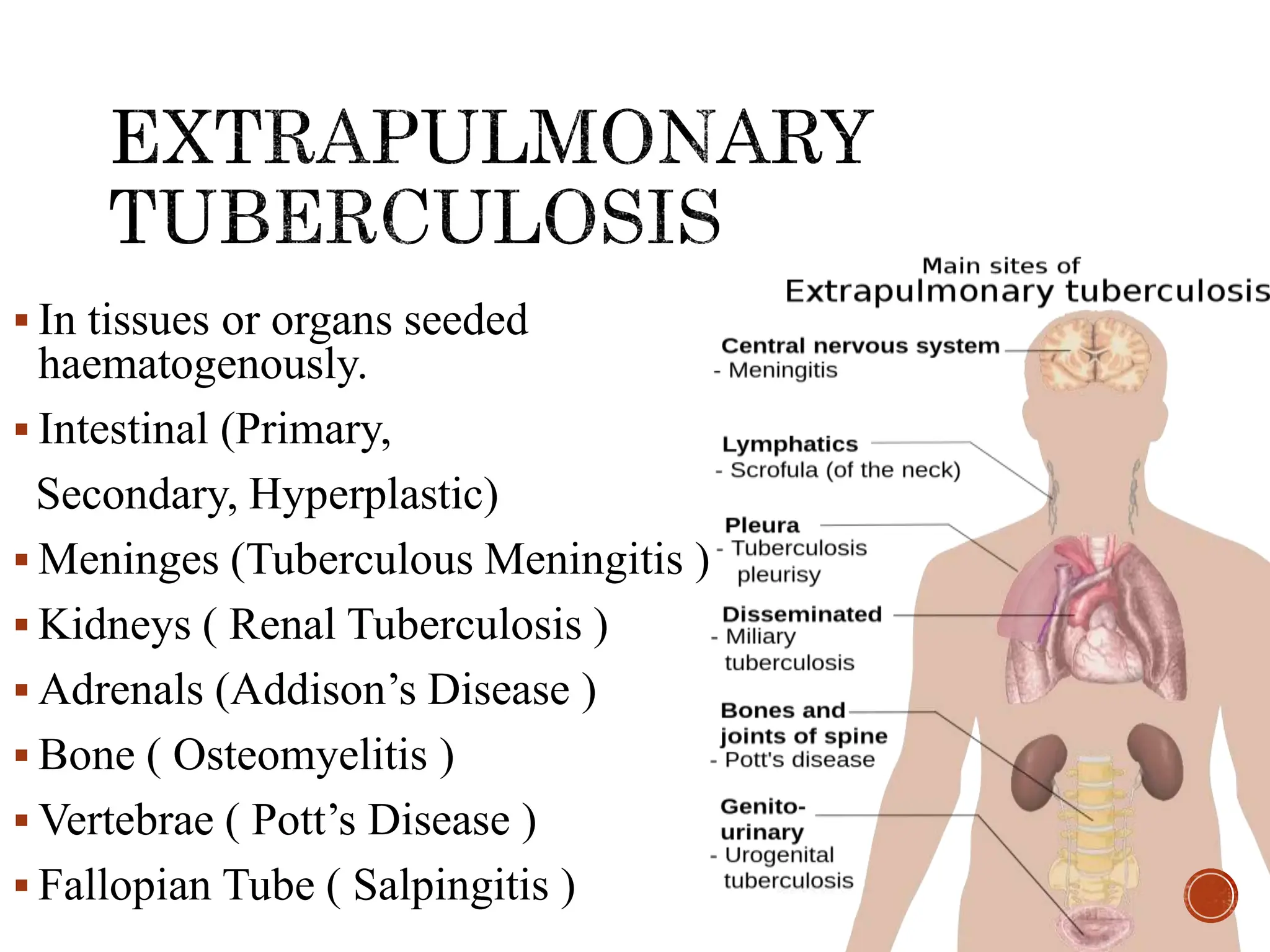 Pathophysiology of Tuberculosis and it's Complications | PPTX ...