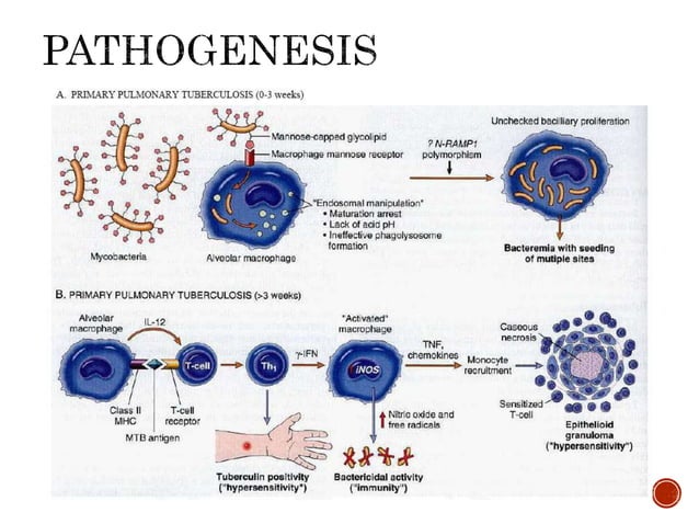 Pathophysiology of Tuberculosis and it's Complications | PPTX ...