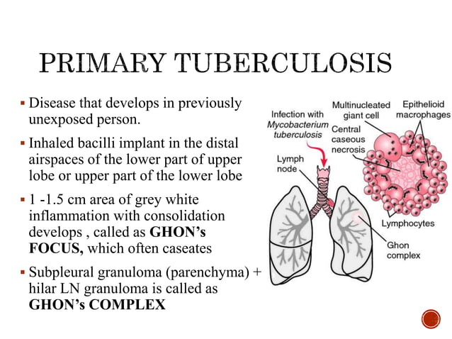 Pathophysiology of Tuberculosis and it's Complications | PPTX ...