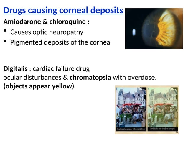 Pharmacology of Drugs acting on the eye.ppt