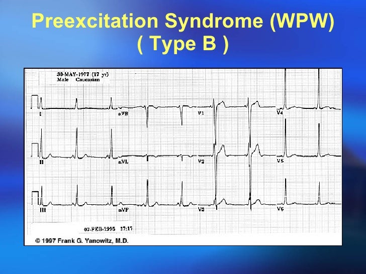 Cardiovascular System