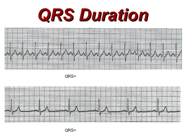 Cardiac Electrophysiology