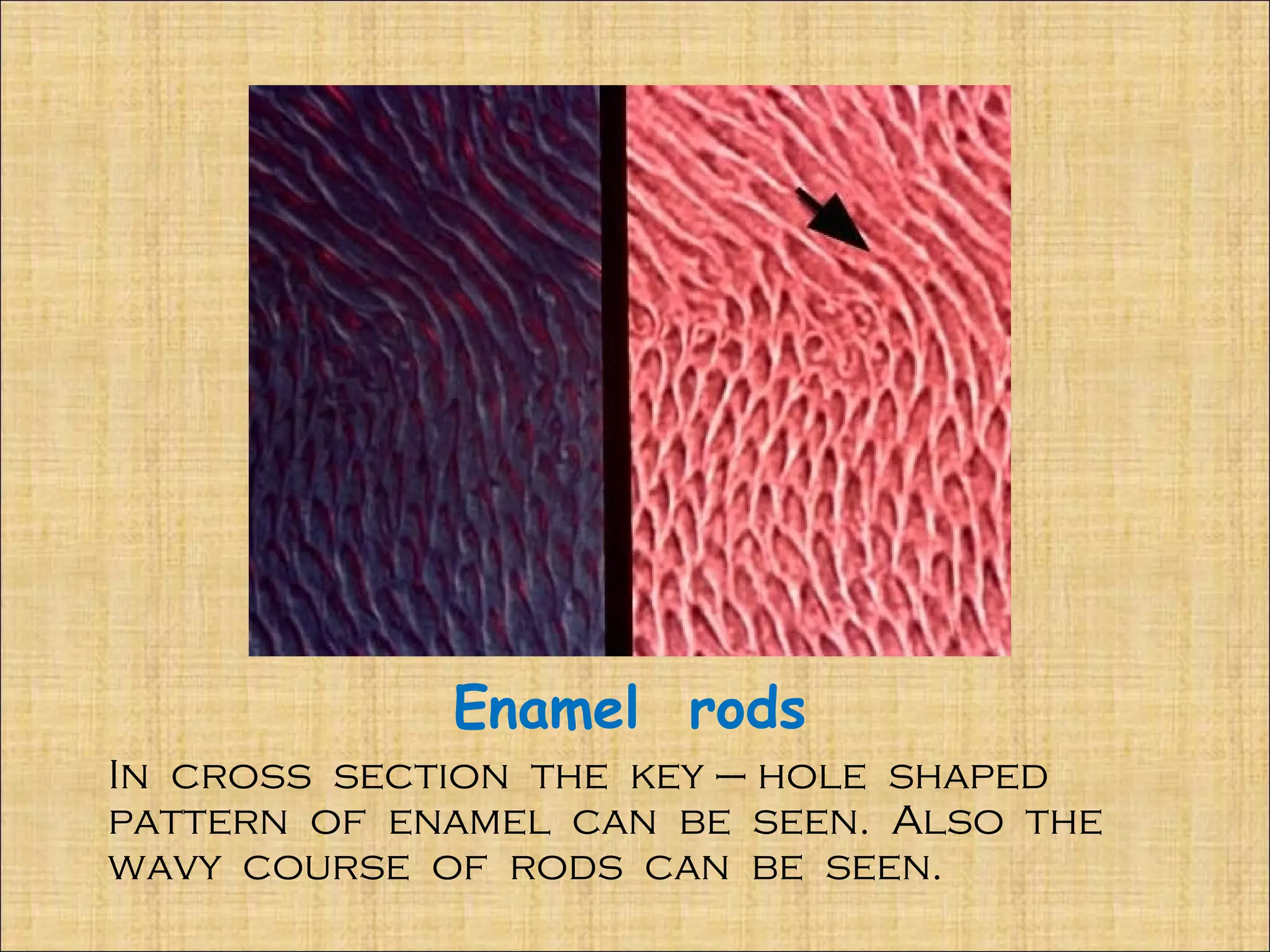 1 enamel dentin pulp | PPT