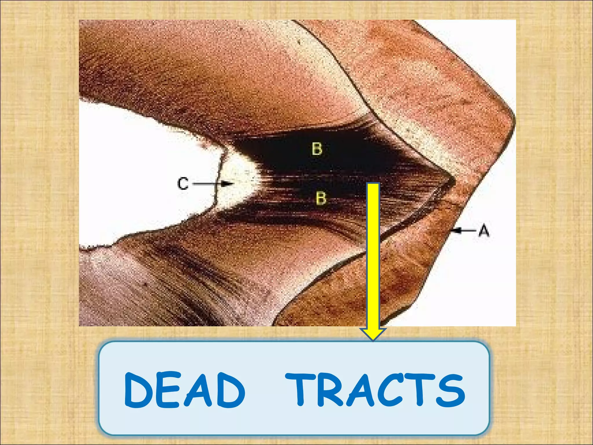 1 enamel dentin pulp | PPT
