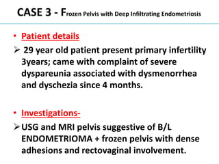 Management of Infertility With Endometriosis Clinical Practice ...