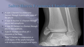 1EPIPHYSEAL INJURIES .pptx
