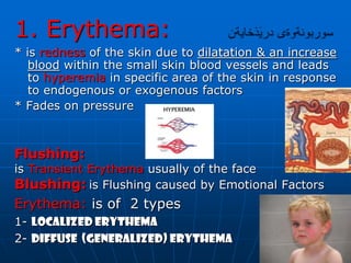 dermatology.1 eryth, telan, urt & hshp(dr.faraydwn) | PPTX