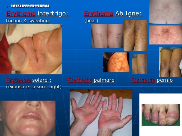 dermatology.1 eryth, telan, urt & hshp(dr.faraydwn)