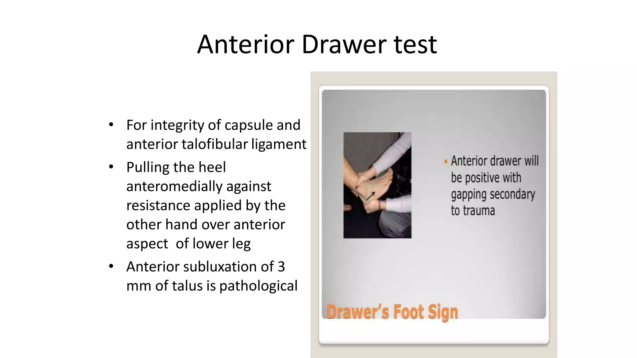 1 Evaluating for Syndesmotic injury.pptx