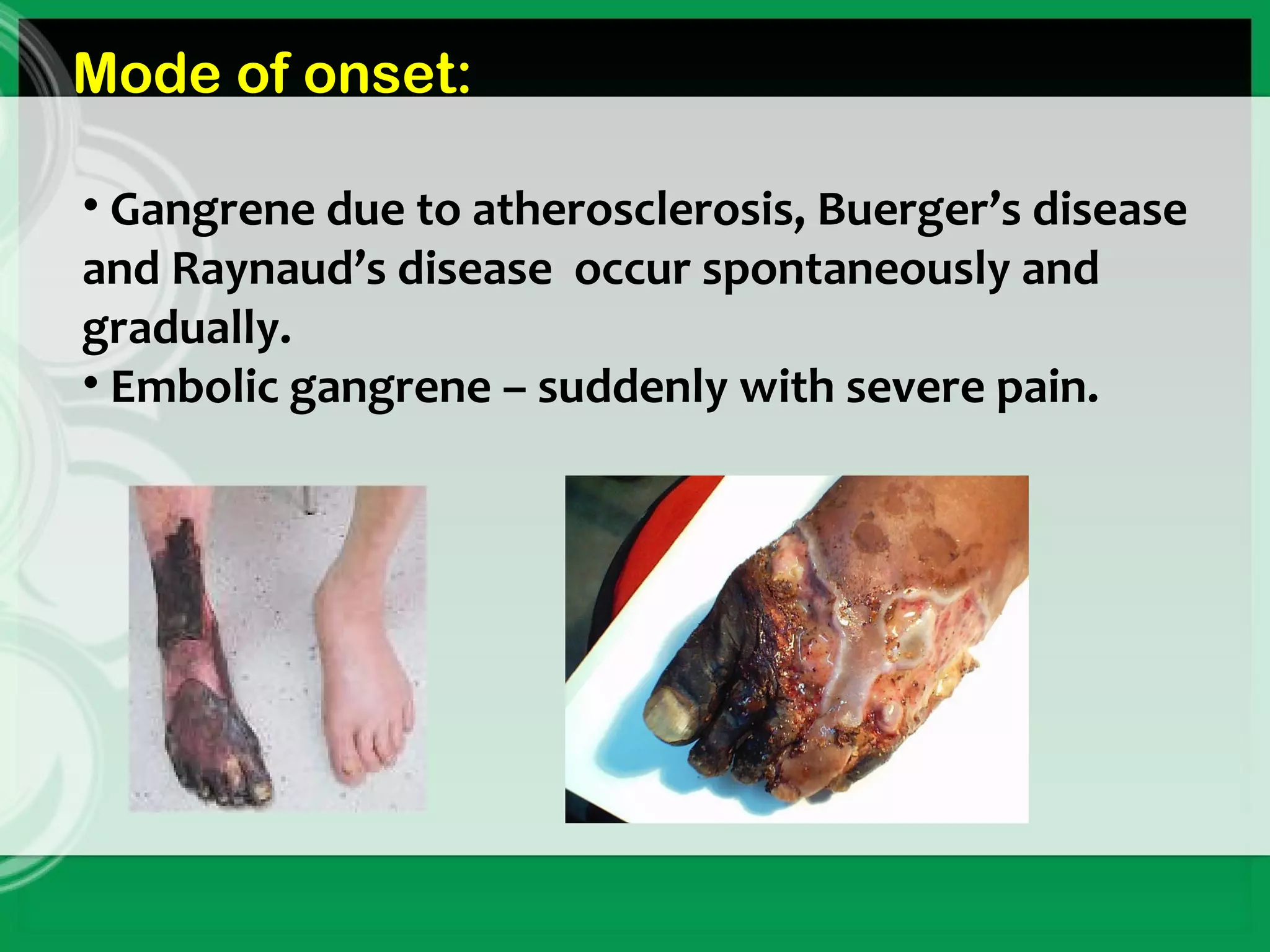 perpheral vascular disease & gangrene examination | PPT