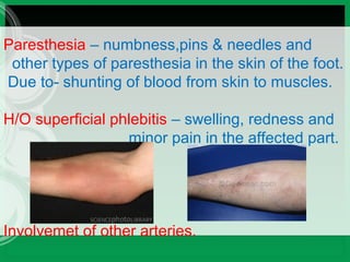 perpheral vascular disease & gangrene examination | PPT